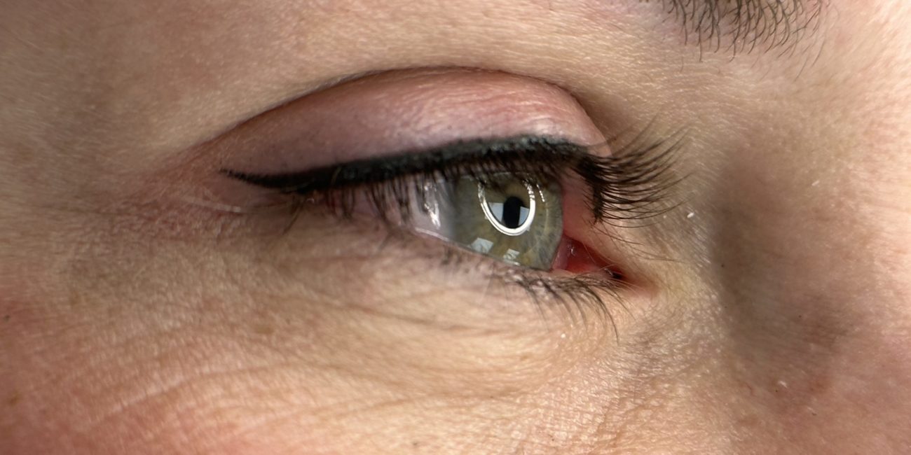 Deepliner PMU Training - MOOI Institute